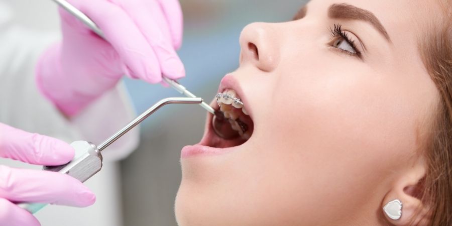 ¿Qué es una úlcera bucal o aftas? | Clínica DentAll | Dra. Pascual